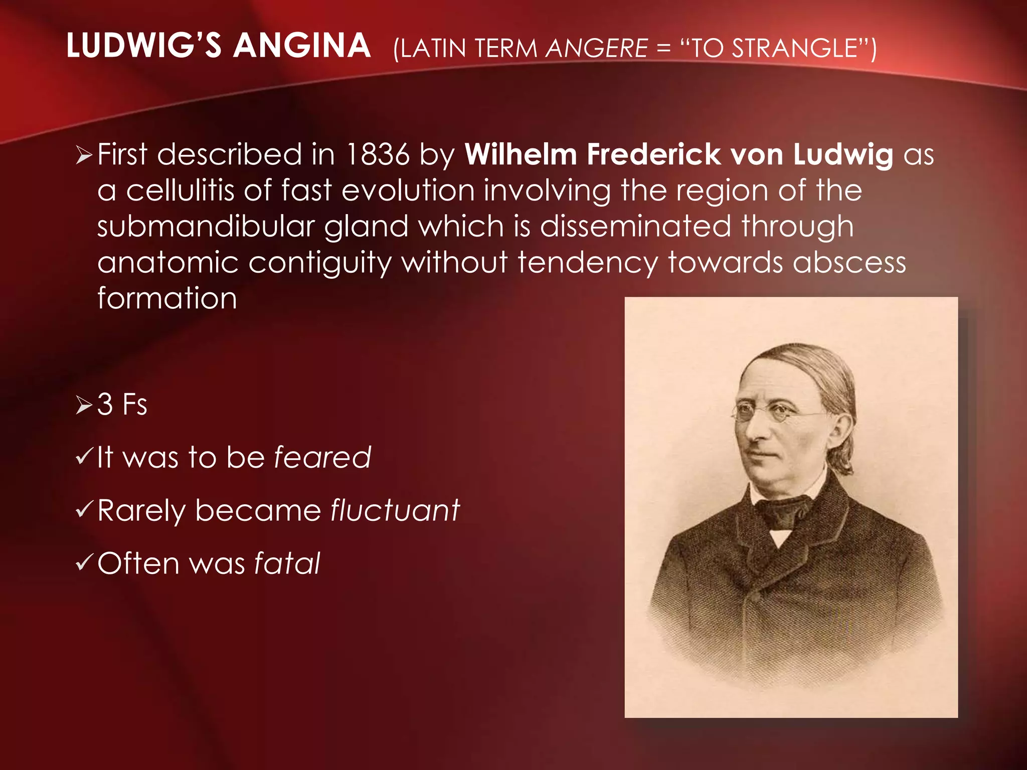 Ludwig’s angina | PPTX