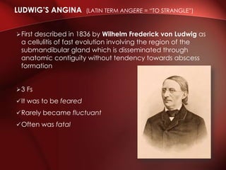 Ludwig’s angina | PPTX