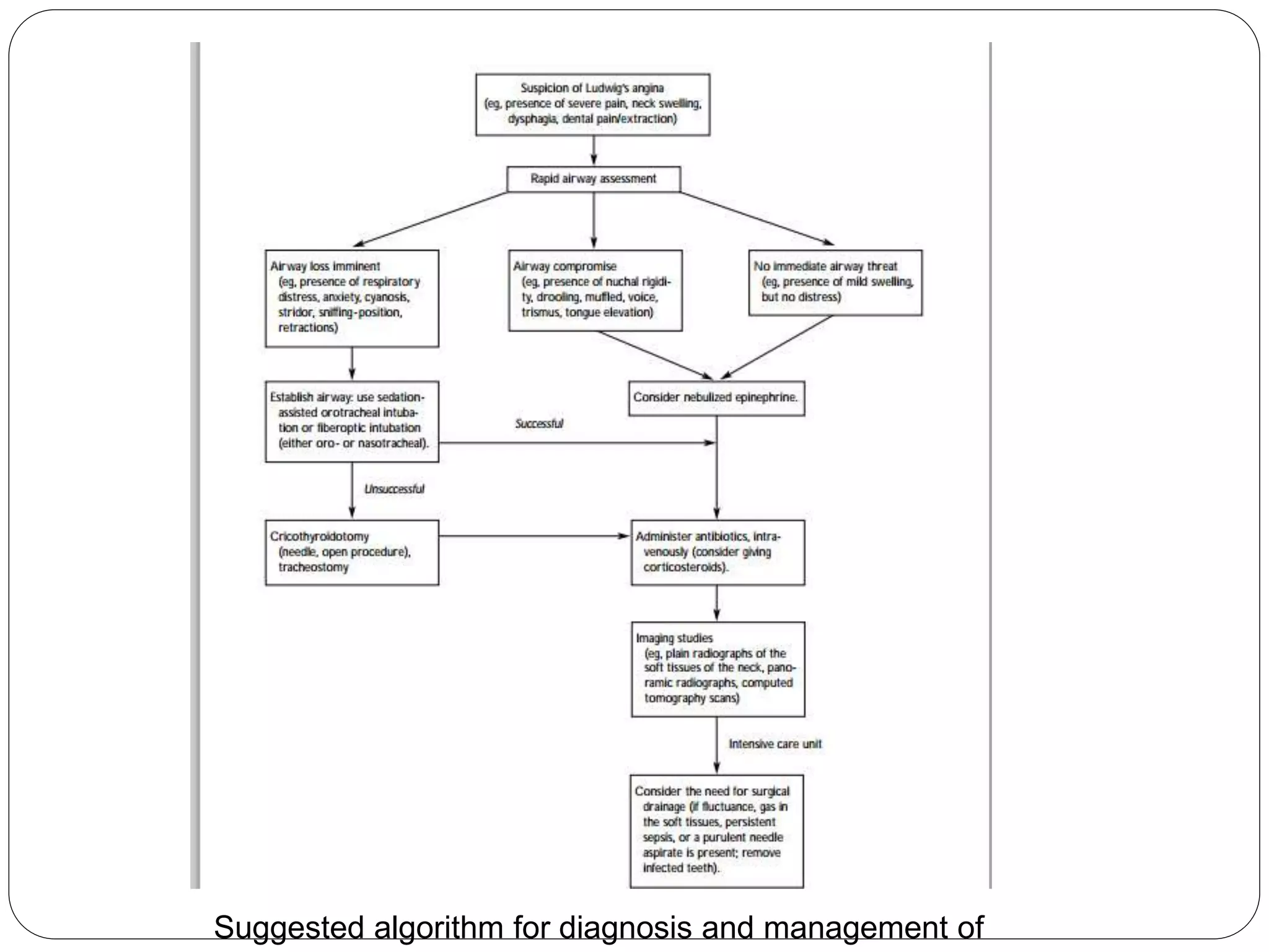 Ludwigs angina | PPTX