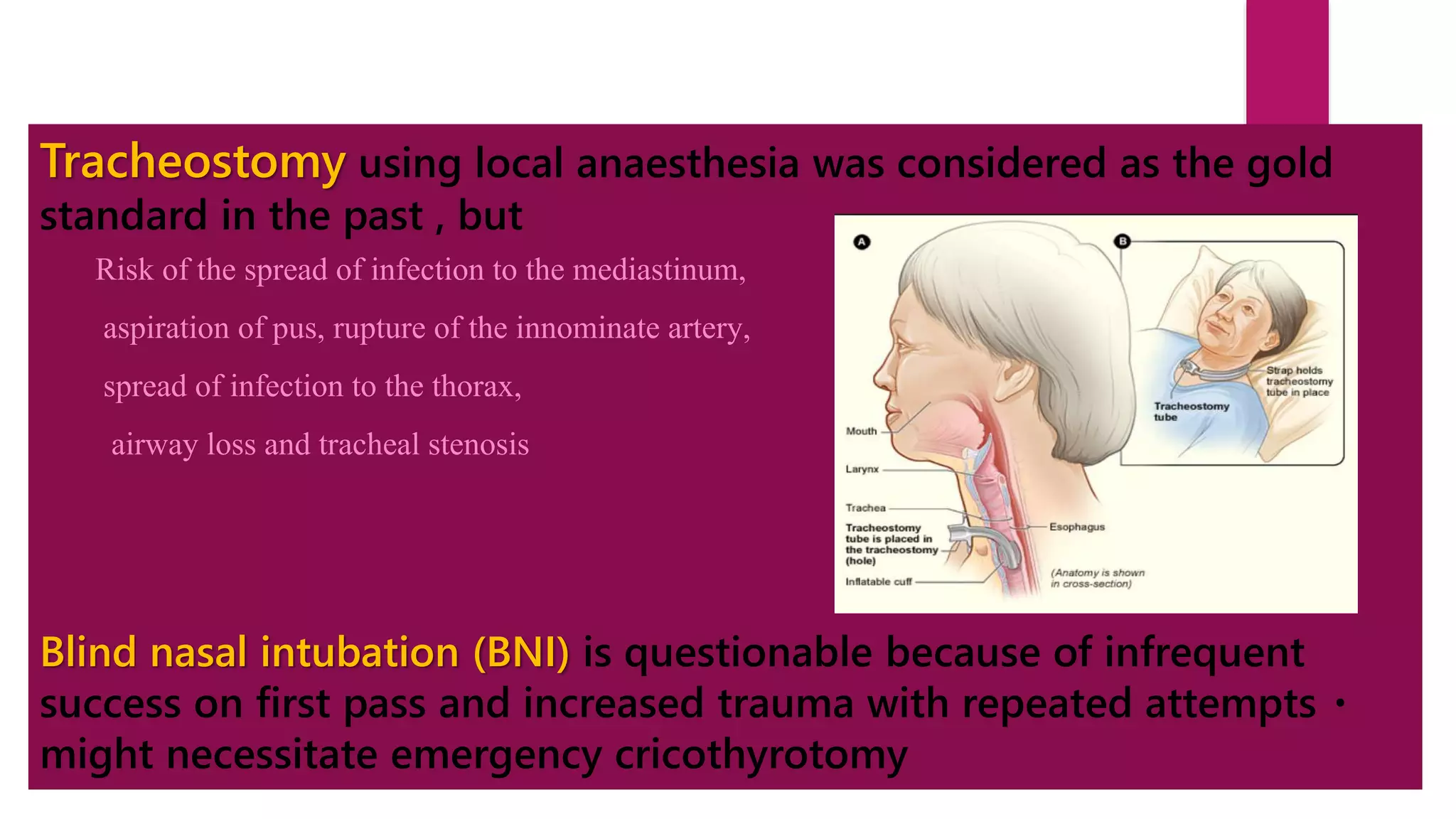 Ludwig's angina | PPTX