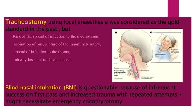 Ludwig's angina | PPTX | Ear, Nose and Throat Conditions | Diseases and ...