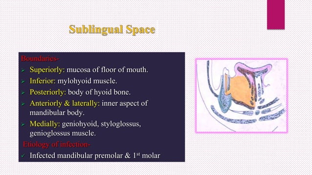 Ludwig's angina | PPTX | Ear, Nose and Throat Conditions | Diseases and ...