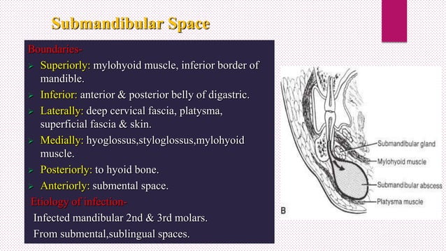 Ludwig's angina | PPTX | Ear, Nose and Throat Conditions | Diseases and ...