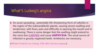 Ludwig's angina | PPTX