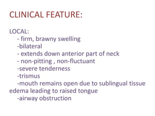 Ludwig’s angina | PPTX