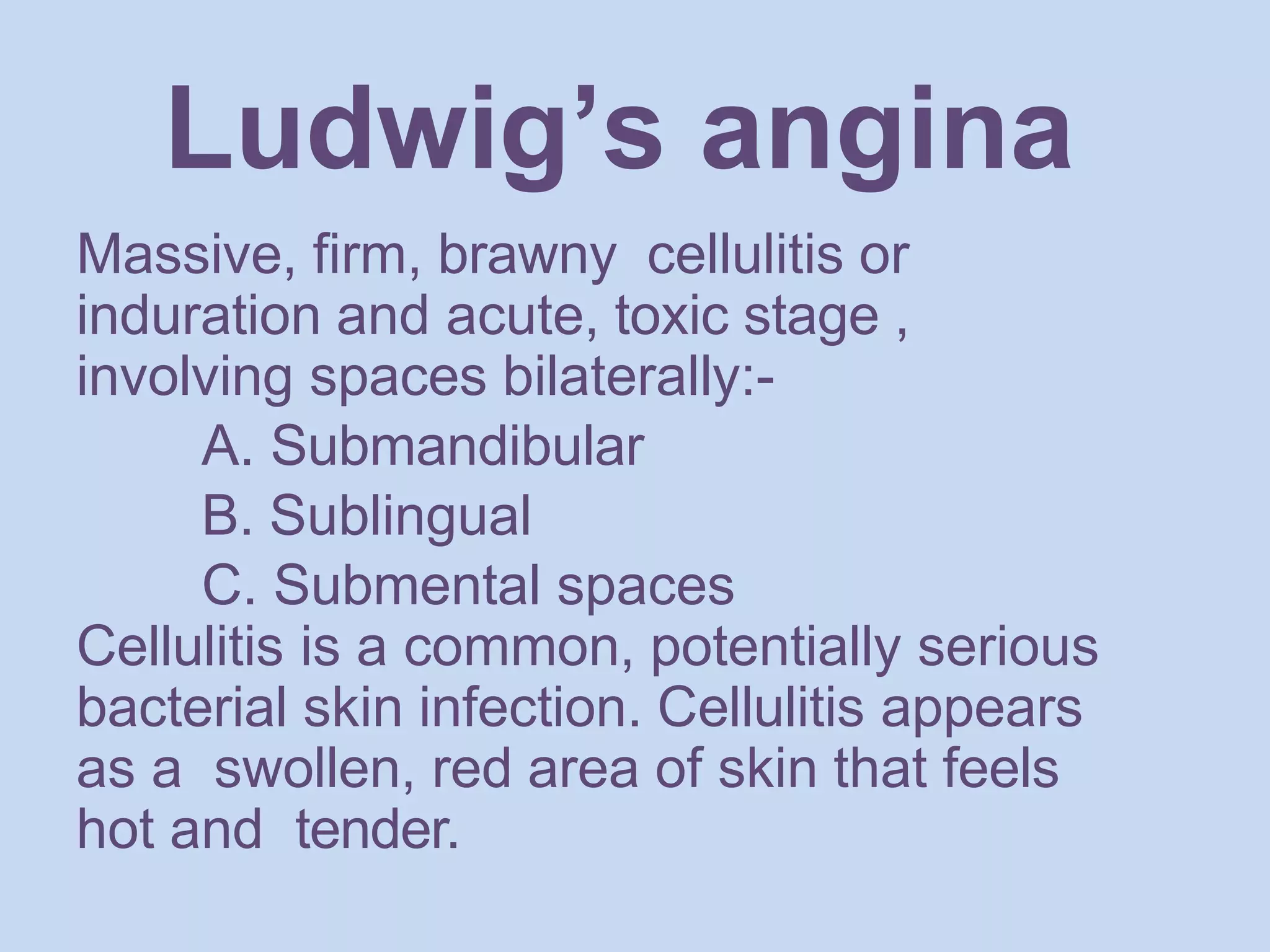 Ludwig's angina | PPTX