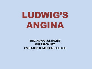 Ludwig's angina | PPTX