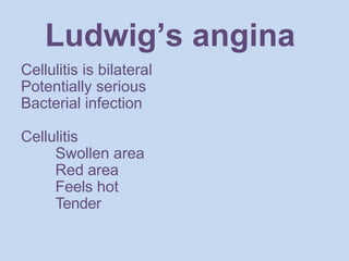 Ludwig's angina | PPTX