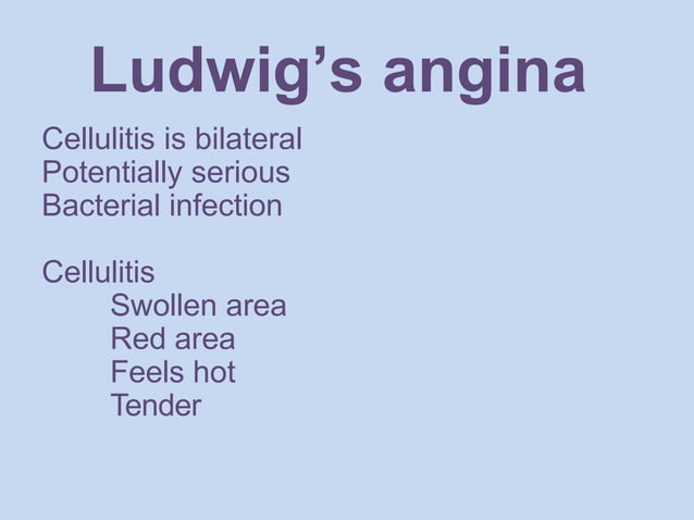 Ludwig's angina | PPTX | Ear, Nose and Throat Conditions | Diseases and ...