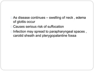 Ludwigs angina | PPTX