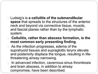 Ludwigs angina | PPTX