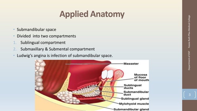 LUDWIGS ANGINA.pptx | Ear, Nose and Throat Conditions | Diseases and ...