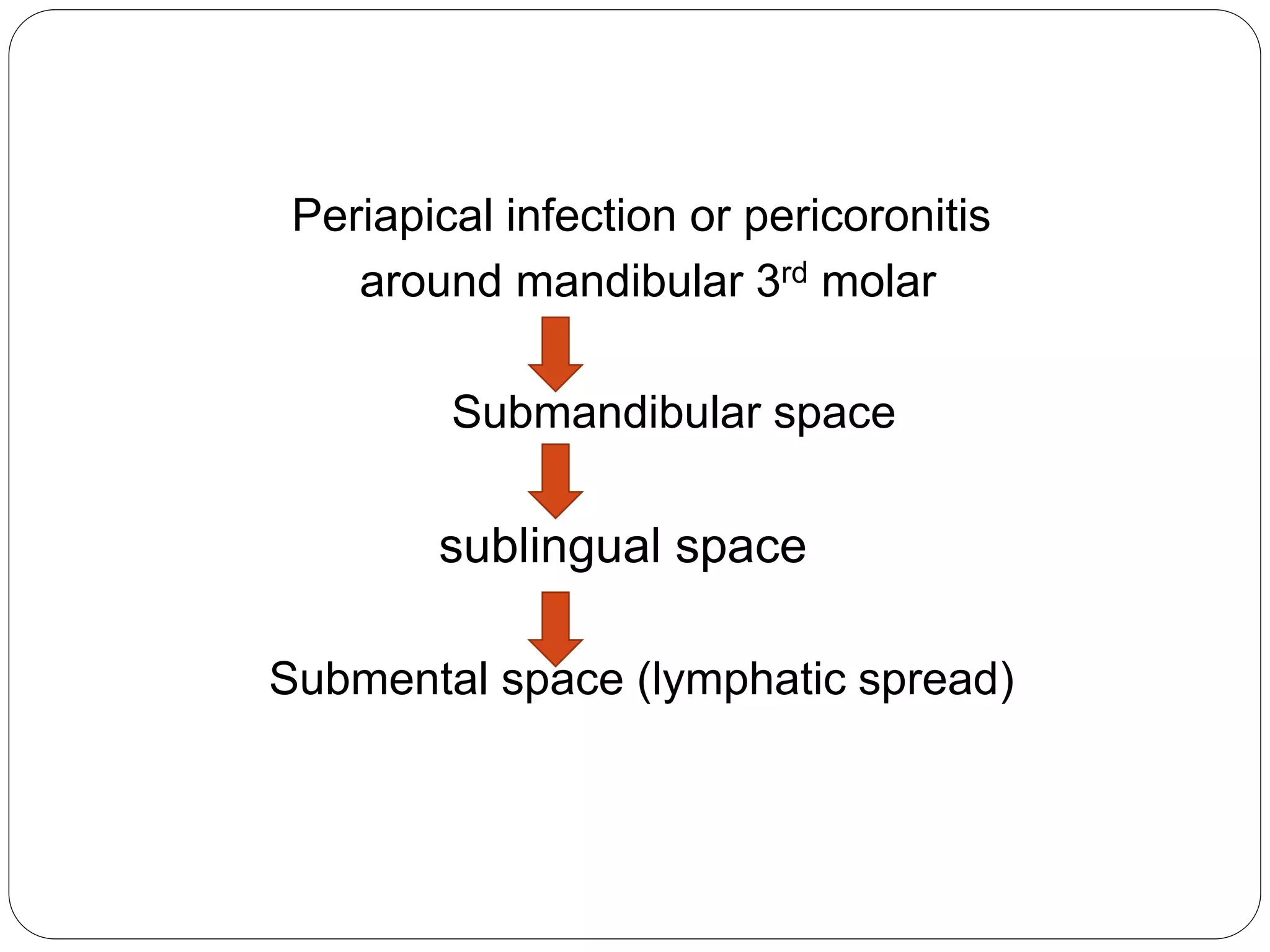 LUDWIG’S ANGINA - DAVISpptx | PPTX