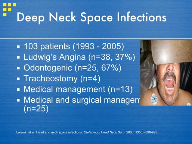 Ludwigs angina & anaesthetic management | PPT | Dental Health ...