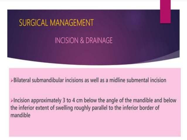 Ludwig`s Angina history and examination and management.pptx | Ear, Nose ...