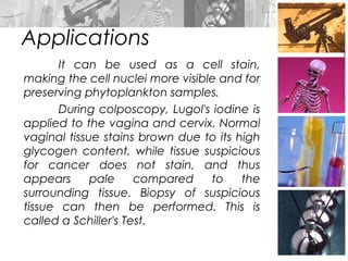 Lugol's solution | PPT