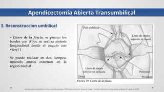 Apendicectomia transumbilical abordaje minimo | PPTX