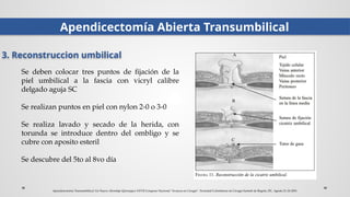 Apendicectomia transumbilical abordaje minimo | PPTX