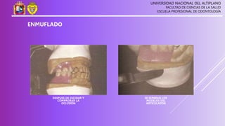 Enmuflado, acrilizado y pulido de la PPR.pptx