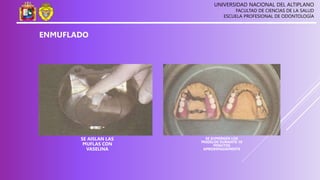 Enmuflado, acrilizado y pulido de la PPR.pptx