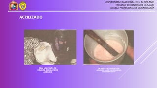 Enmuflado, acrilizado y pulido de la PPR.pptx