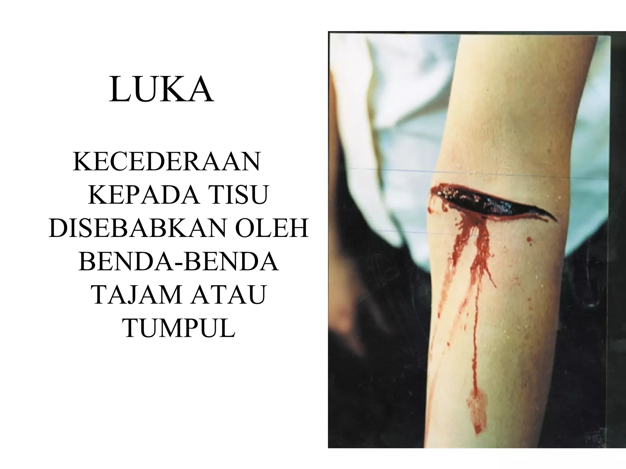 Luka Dan Pendarahan | PPT