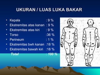 Luka bakar | PPT