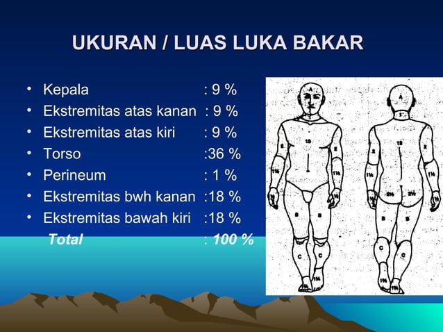 Luka bakar | PPT