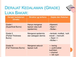 Luka bakar | PPT