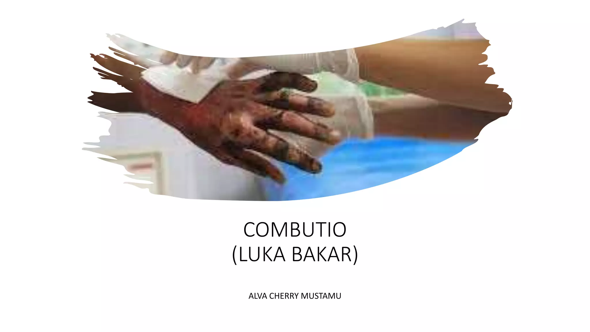 Luka bakar | PPTX