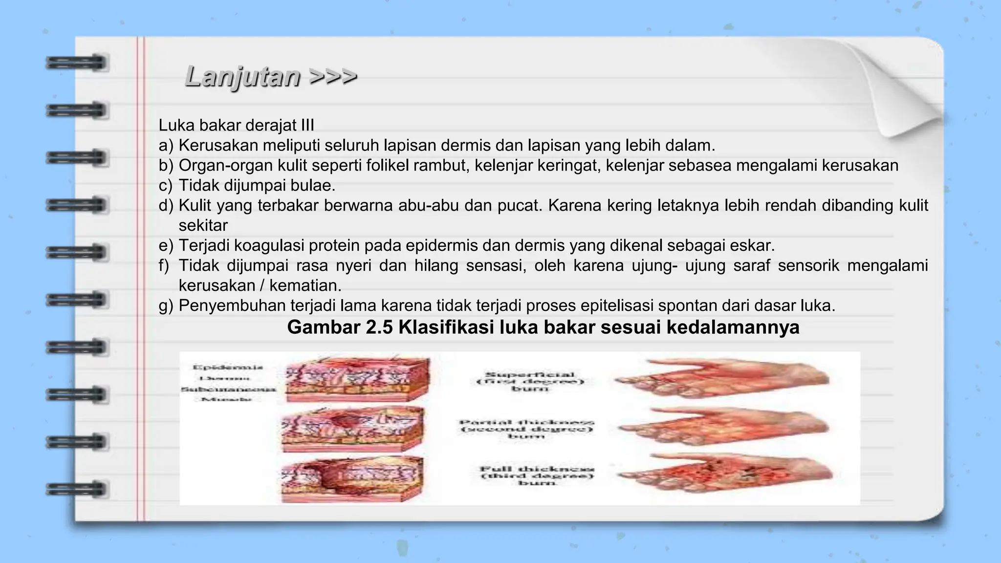 manajemen luka bakar kelompok 2,perawatan luka bakar | PPTX