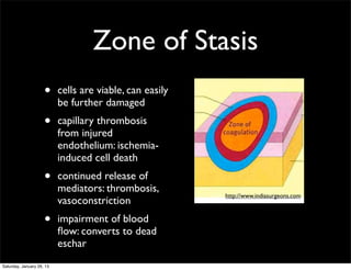 Luka Bakar -- Refreshment Meeting | PPT
