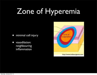 Luka Bakar -- Refreshment Meeting | PPT