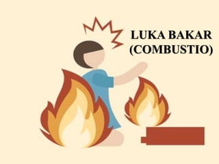 TATA LAKSANA LUKA BAKAR LUKA BAKAR (COMBUSTIO).pptx