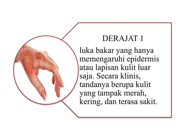 TATA LAKSANA LUKA BAKAR LUKA BAKAR (COMBUSTIO).pptx