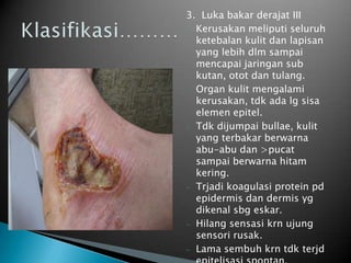 Luka bakar present 2011 | PPT