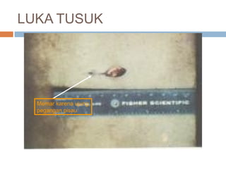 Luka akibat benda tajam & tumpul | PPT