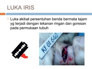 Luka akibat benda tajam & tumpul | PPT