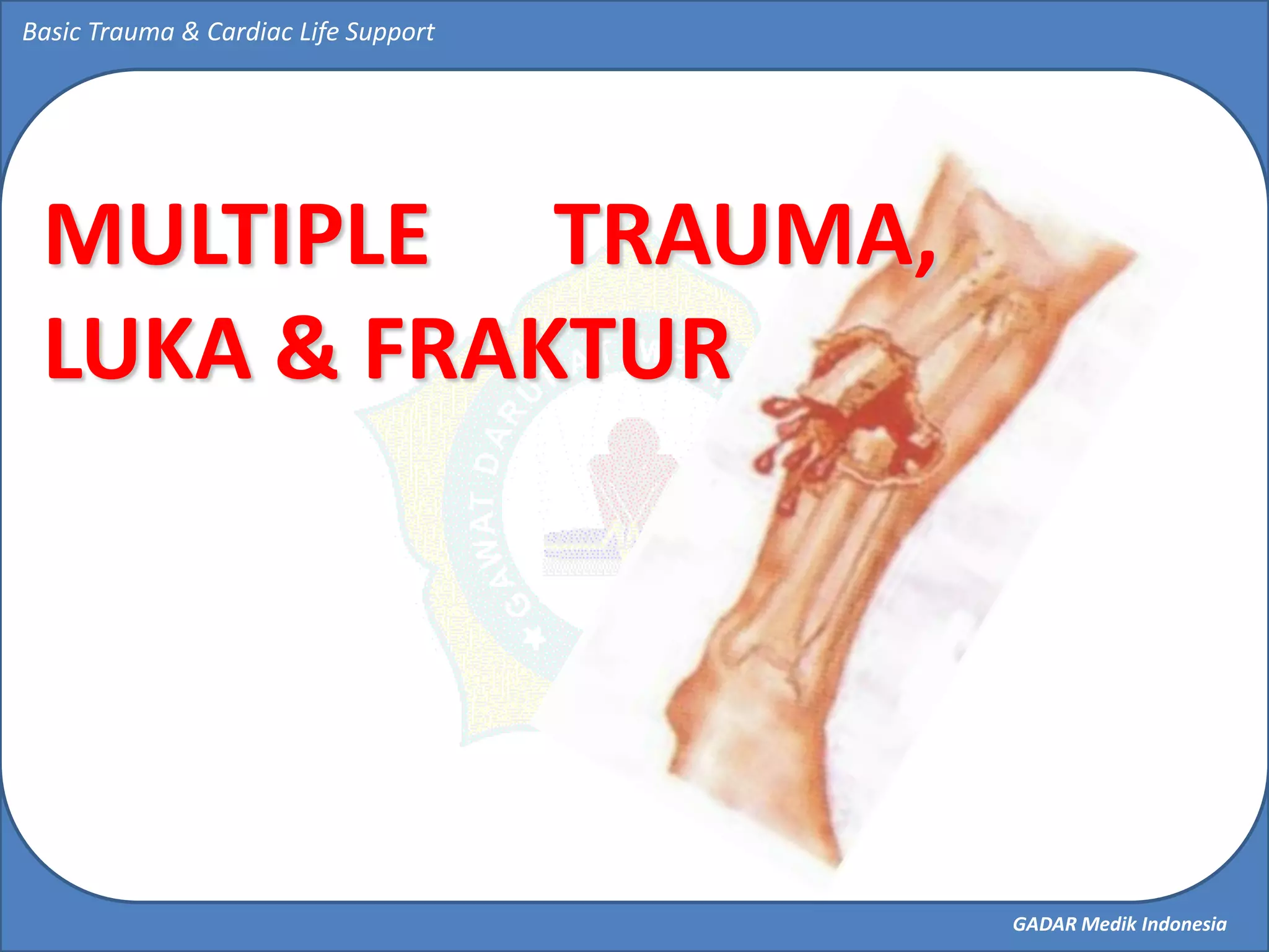 Trauma Luka Dan Fraktur | PDF