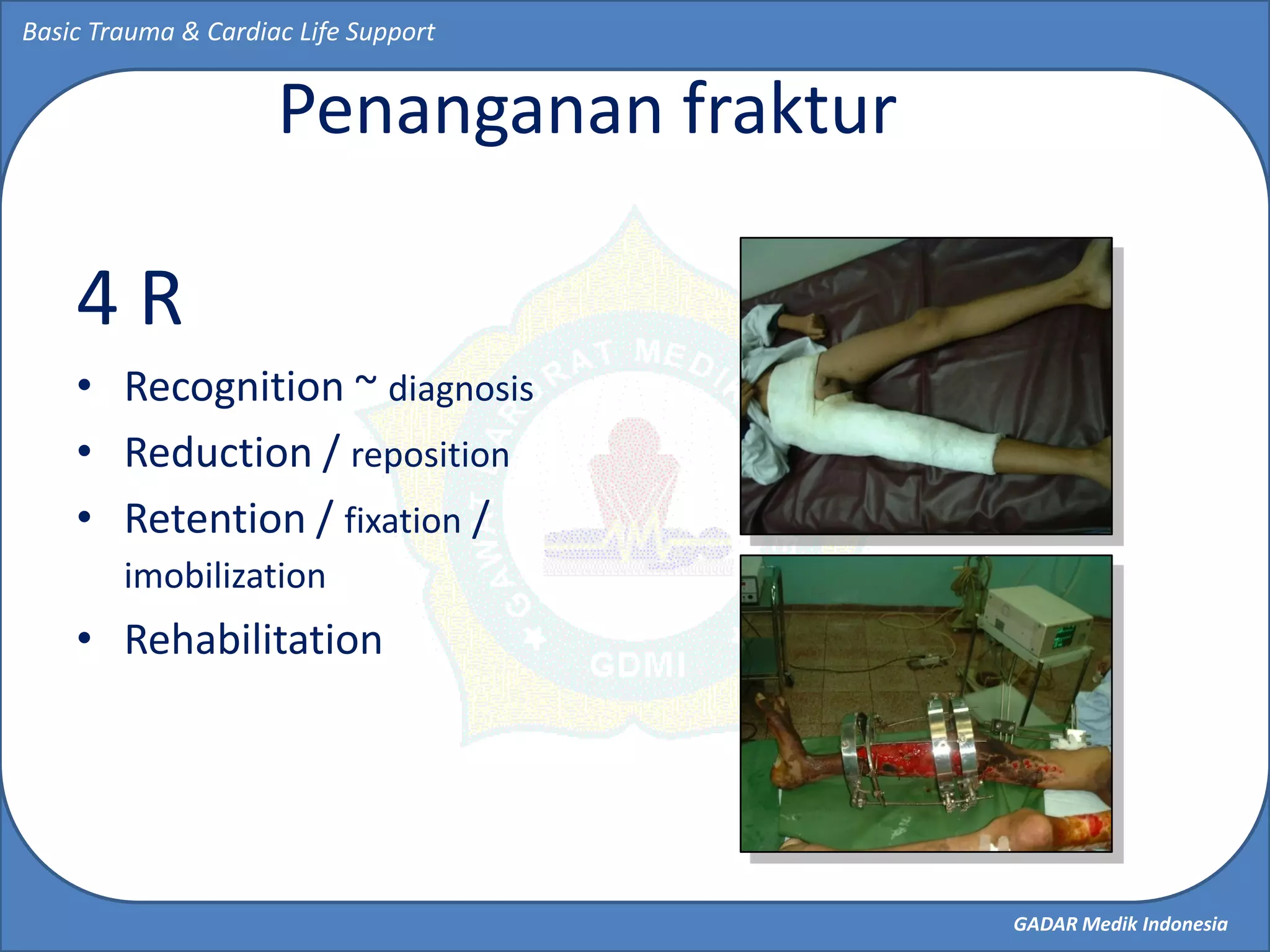 Trauma Luka Dan Fraktur | PDF