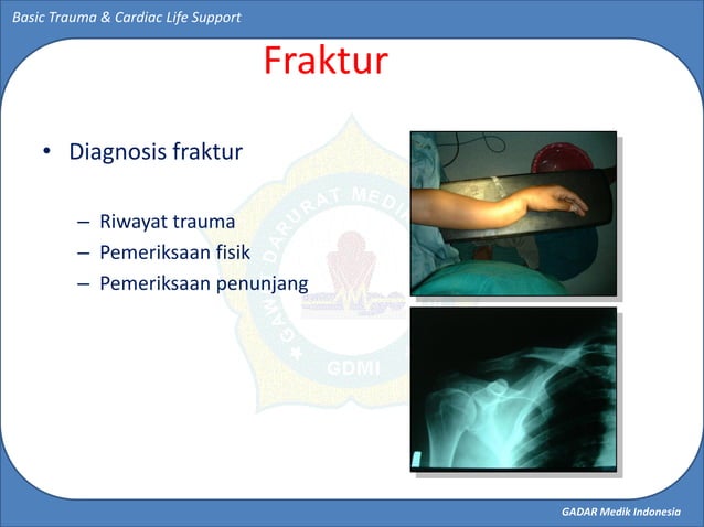 Trauma Luka Dan Fraktur | PDF