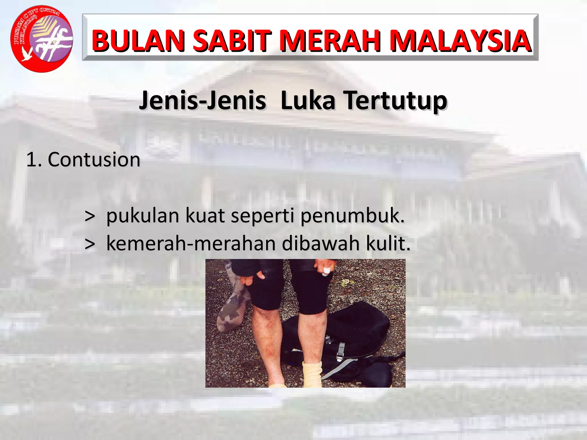 Luka dan pendarahan | PPT
