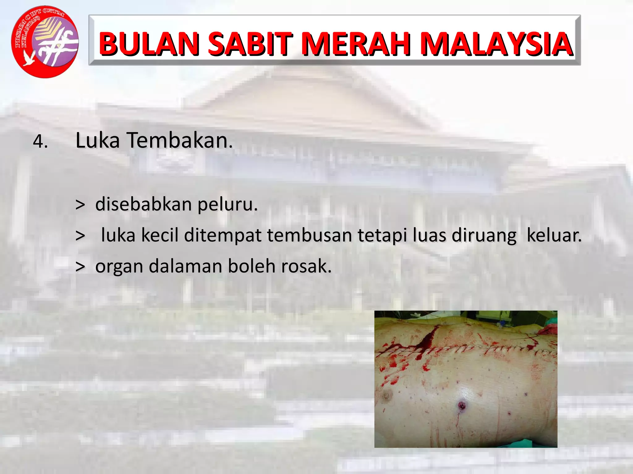 Luka dan pendarahan | PPT