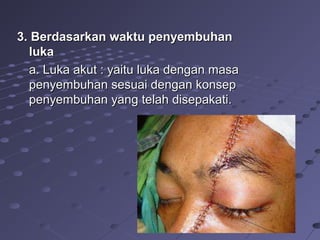 Luka dan perawatan nya | PPT