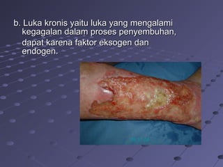 Luka dan perawatan nya | PPT