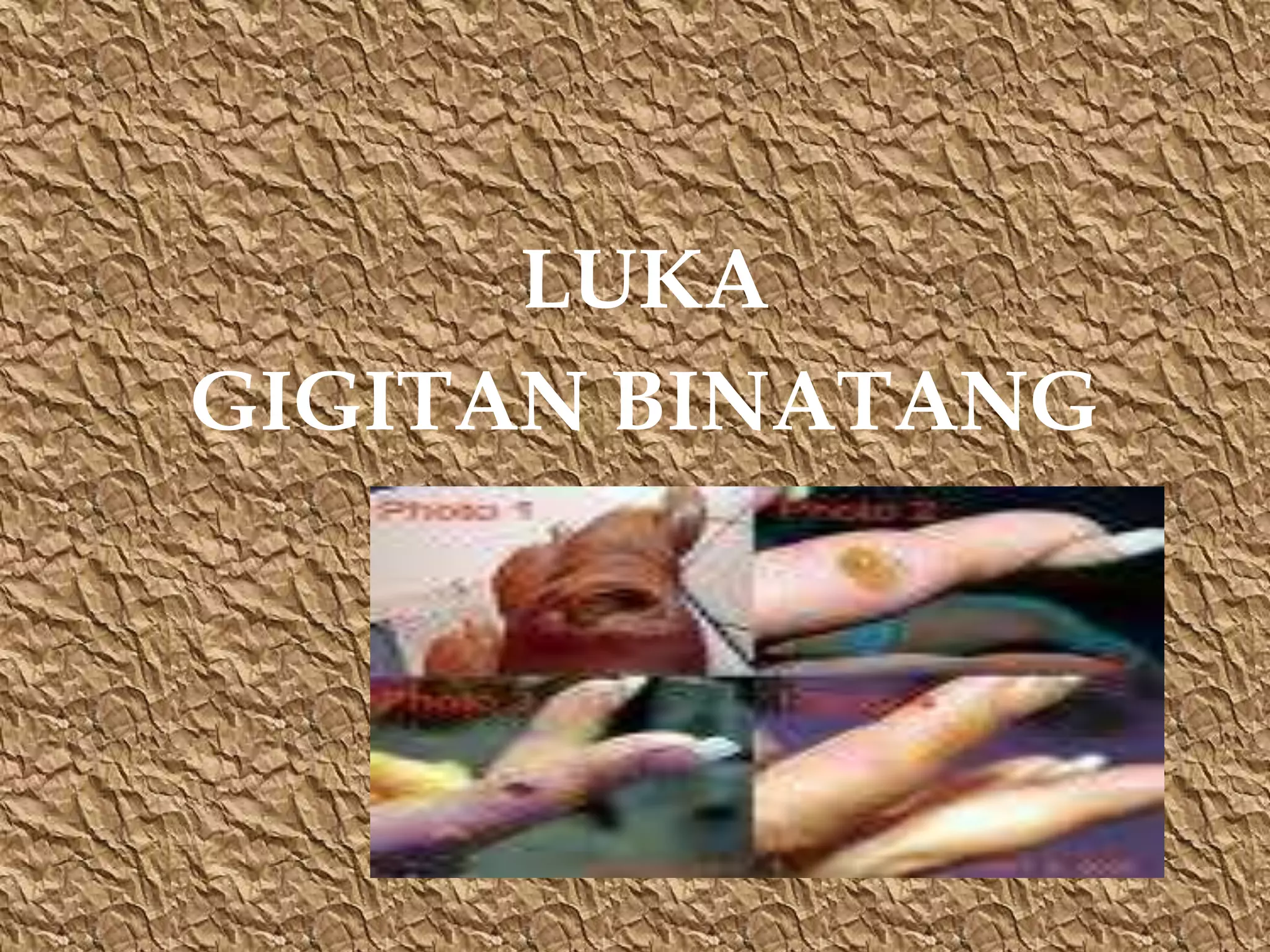 Luka gigitan binatang | PPT