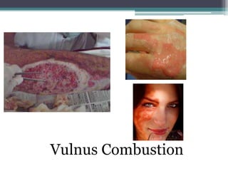 LUKA JENIS.ppt LUKA BERSIH DAN KOROR YH AKIBARTIN | PPT