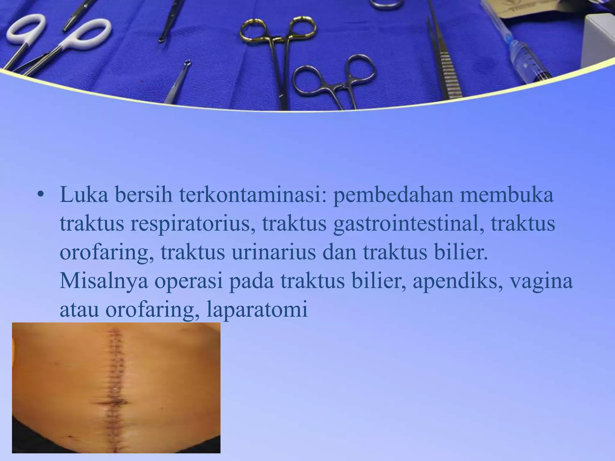 Luka pembedahan | PPT