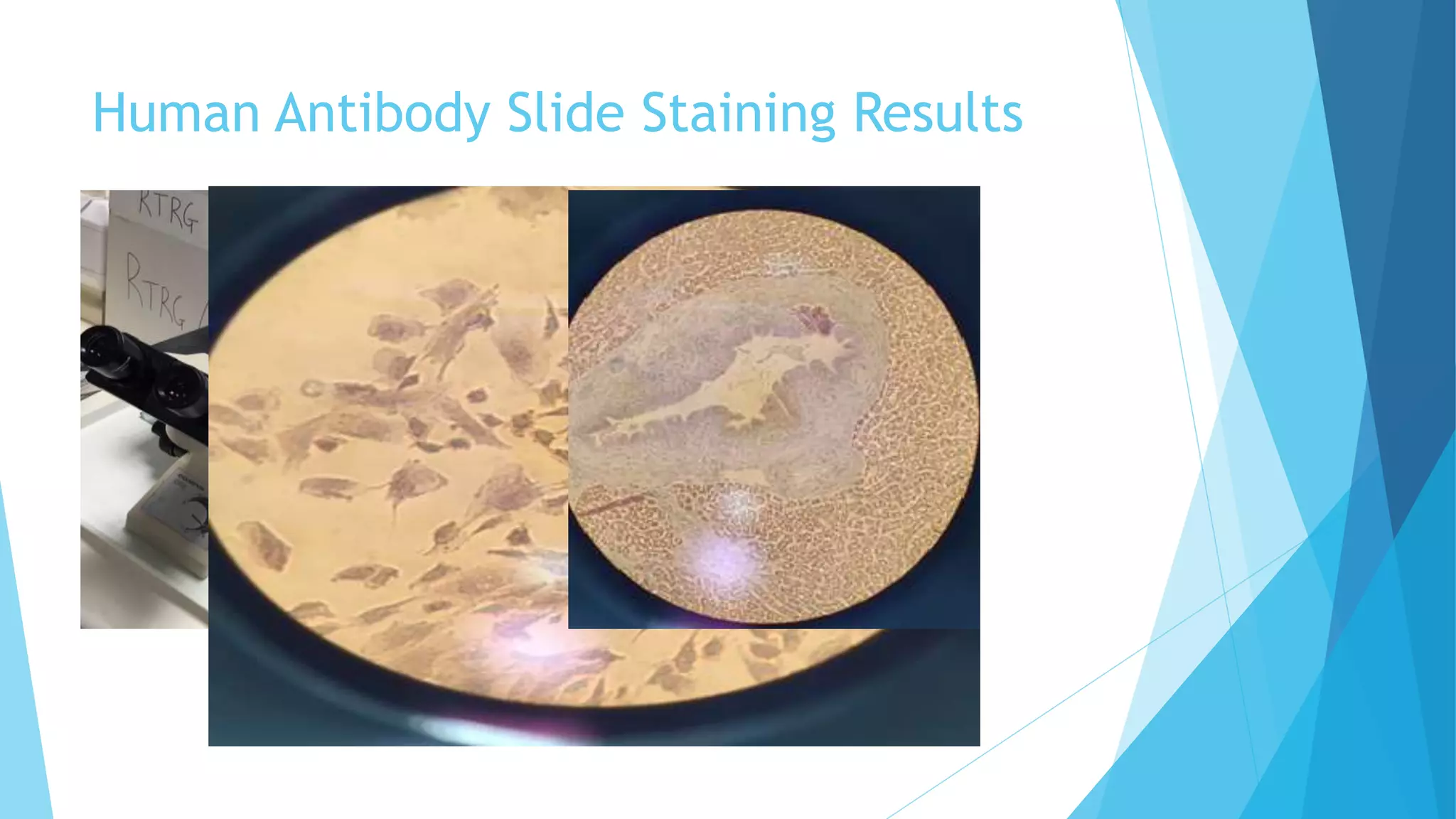 Luke Lomas Work Placement Presentation | PPT