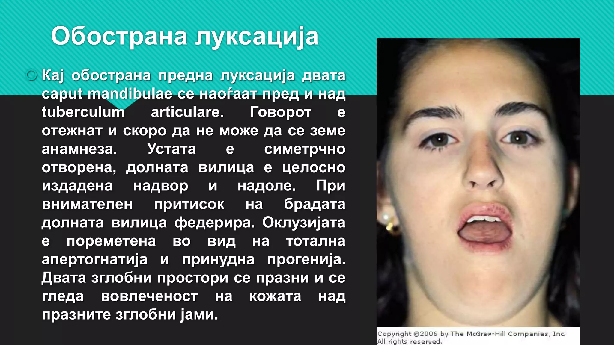 Luksacija na TMZ.pptx